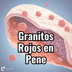 Causas de comezón y manchas rojas en el pene | Nutriaventura